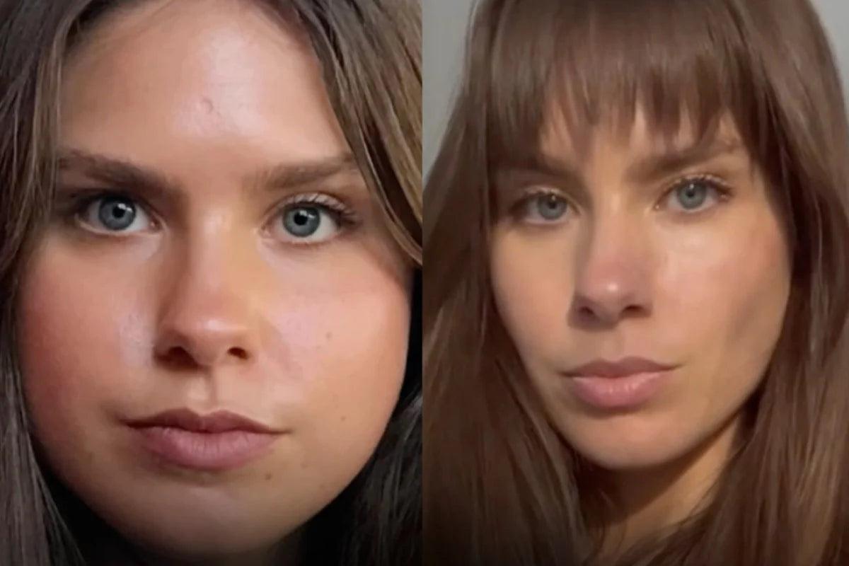 Understanding ‘Moon Face’: How Chronic Stress Affects Your Appearance ...